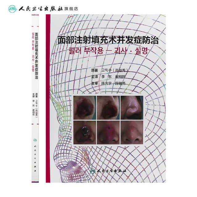 Prevention and treatment of complications of facial injection filling ...