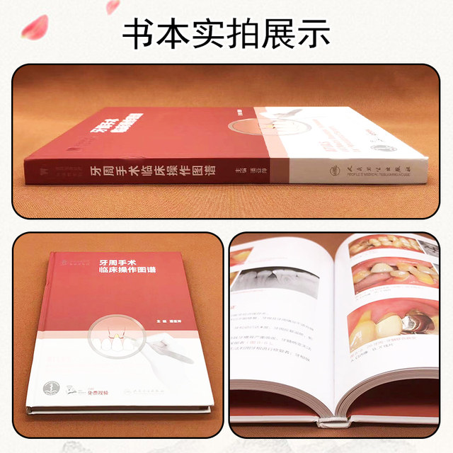 Genuine Periodontal Surgery Clinical Operation Atlas Pan Yaping ...