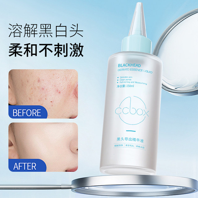 Blackhead export liquid beauty salon blackhead water whole face deep ...