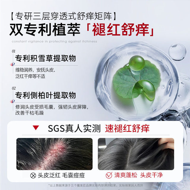 Three magicians Selenium Disulfide Shampoo Anti-dandruff Control Oil ...