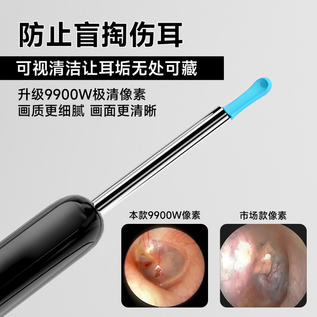 Visual ear pick, ultra-high definition endoscope, smart light-emitting ...