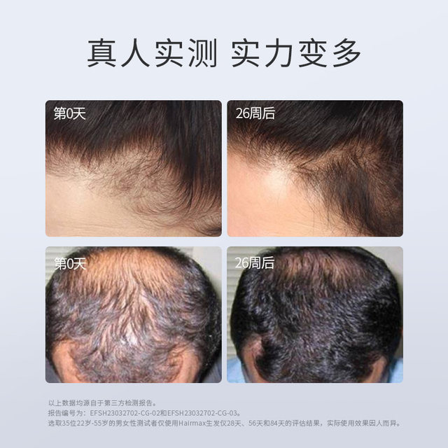 hairmax9 beam low energy red light hair growth instrument healthy hair ...