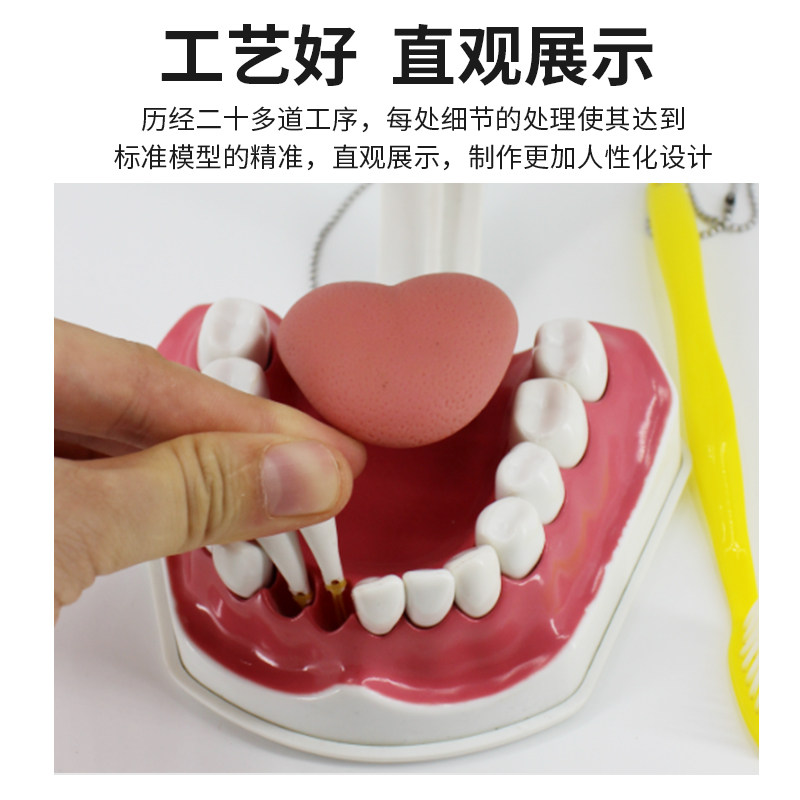 Advanced Large Human Oral Cavity Tooth Model, 6X Scale Tooth Structure