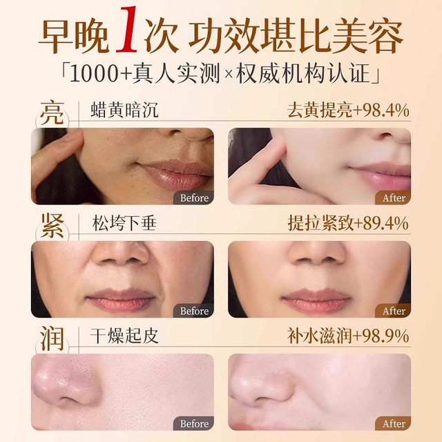 Astragalus cream official genuine dark yellow-removing old brand ...