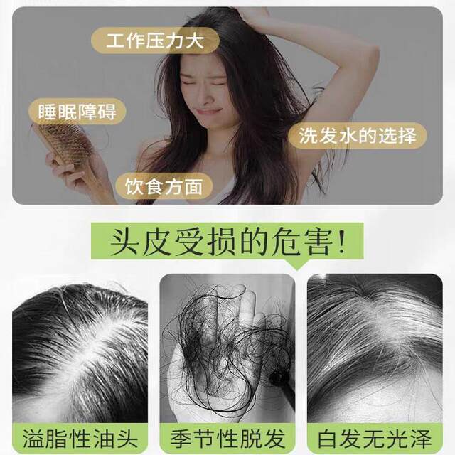 Xinjiang Usman grass shampoo domestic genuine hair growth and hair care ...