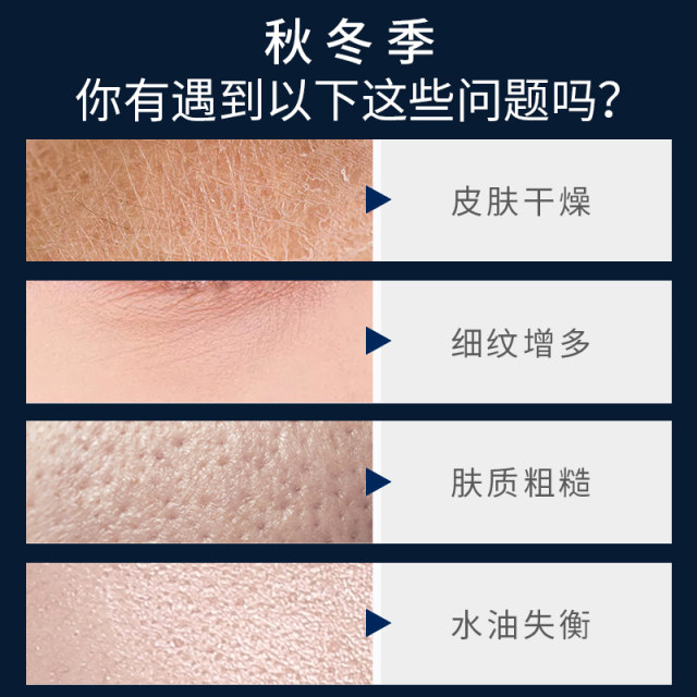 Boys' skin care products flagship store special cream for hydrating and ...