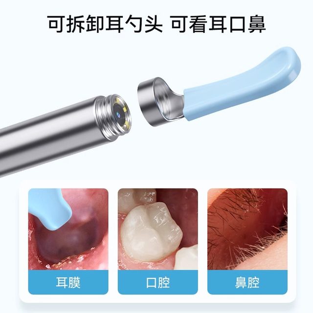 Visual ear pick, ultra-high definition endoscope, smart light-emitting ...