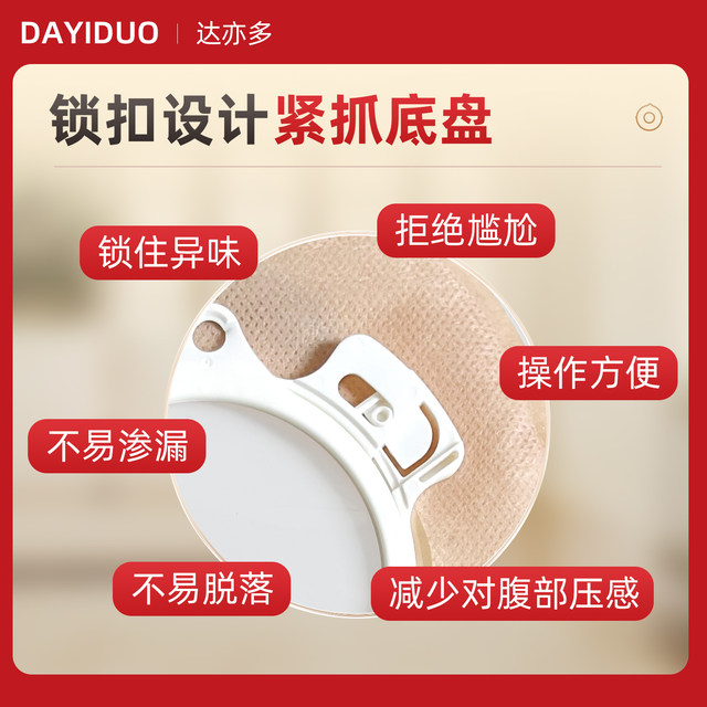 Two-piece ostomy chassis, two-piece ostomy bag, removable rectal cancer ...