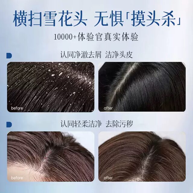 Teenager Selenium Disulfide Shampoo for boys and girls to relieve ...