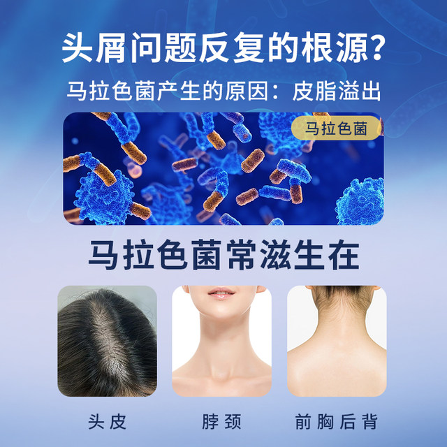 Hillsen Selenium Disulfide Lotion Selenium Disulfide Shampoo Water Oil ...