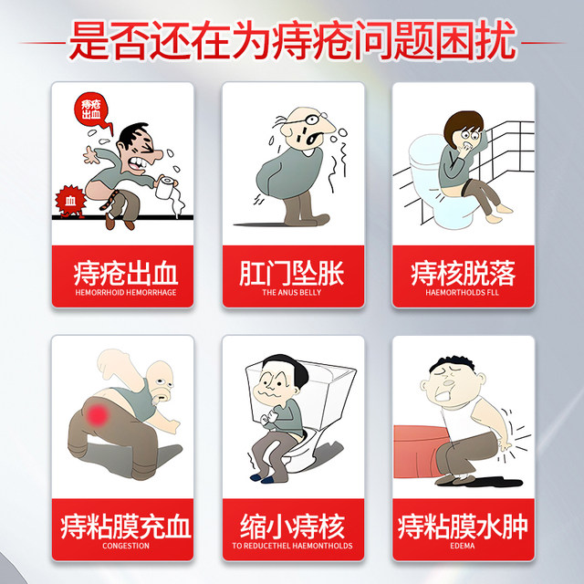 Ma Yinglong Hemorrhoid cream mixed inside and outside hemorrhoid ...