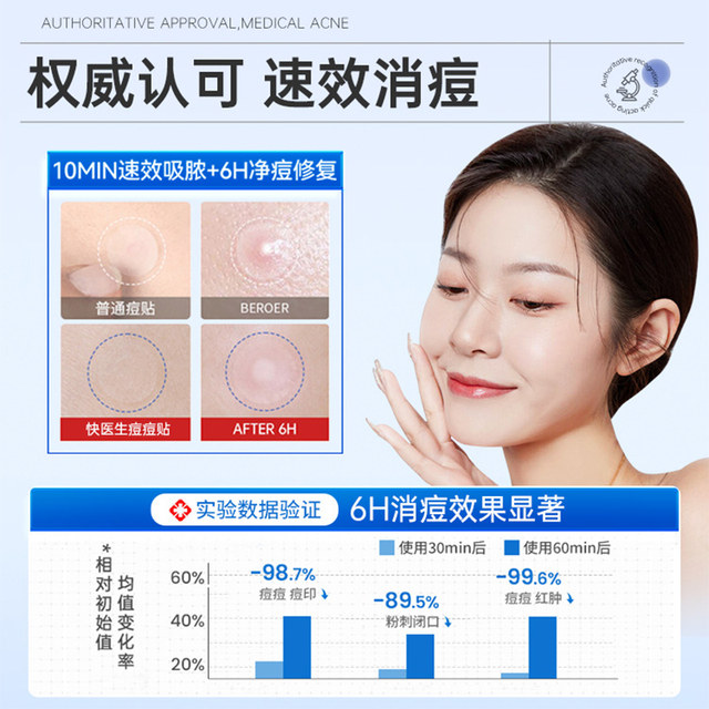 Medical acne patch, acne removal patch, repairing anti-inflammatory ...