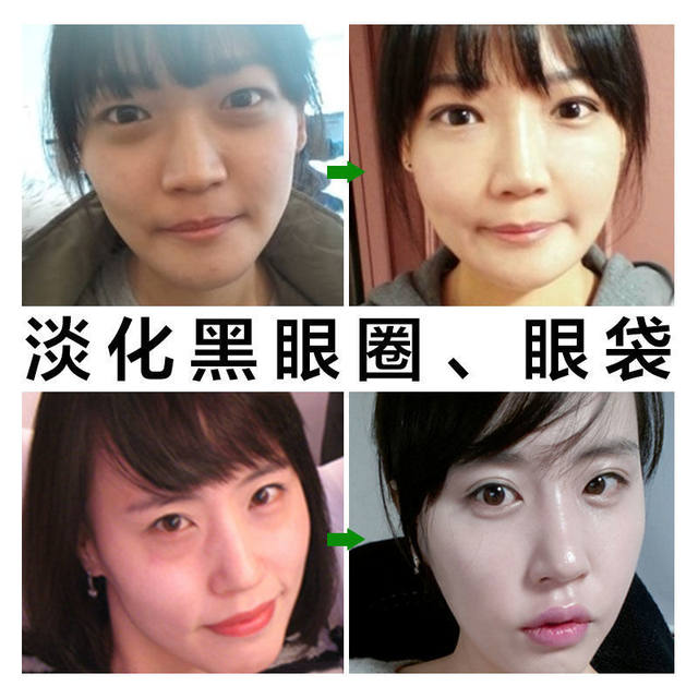 Herborist eye cream dilutes fine lines of eye bags, anti -wrinkle, Bai ...