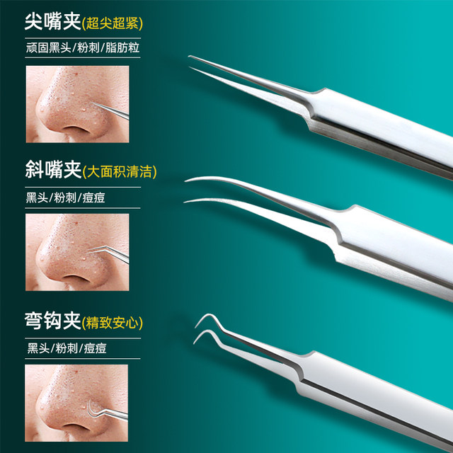 Ultra -sharp cell clipper acupuncture 胞 超 超 超 超 超 痘 痘 超 超 超 超 closed ...