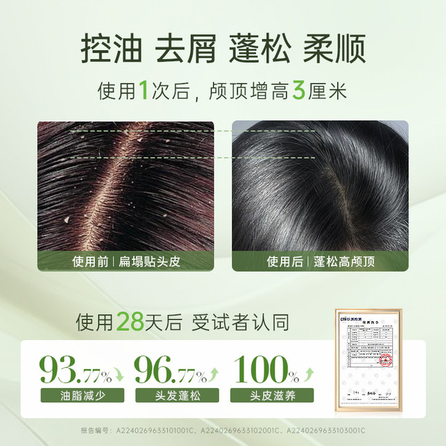 Hope shampoo oil control fluffy plant shampoo anti-dandruff smooth oil ...