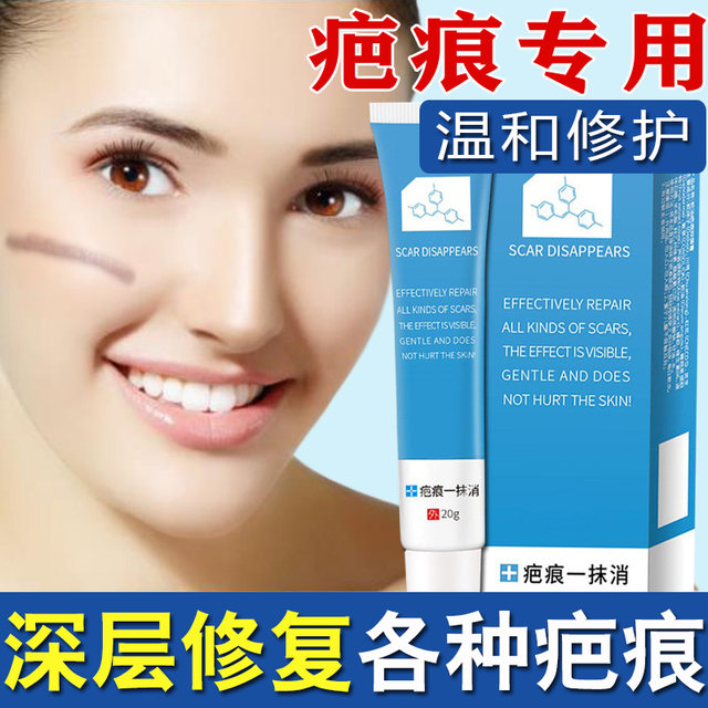 Fix authentic removal cream to pyramid to repair the face scald scar ...