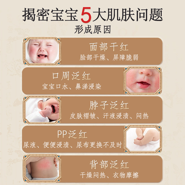 Miaofu Shishile baby lip balm baby saliva balm special lip care balm ...