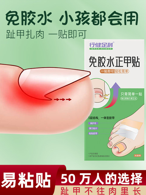 Toenail orthodontic patch, nail groove and ingrown toenail special ...
