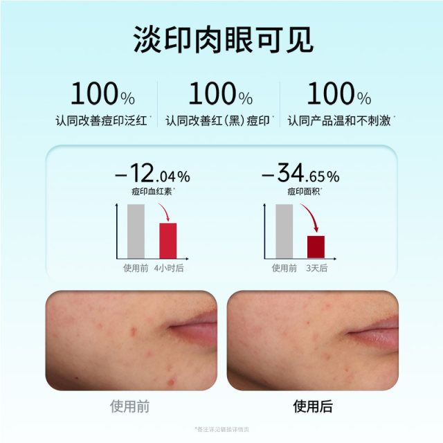 JOVS is proud of its small button electronic acne patch, acne patch ...