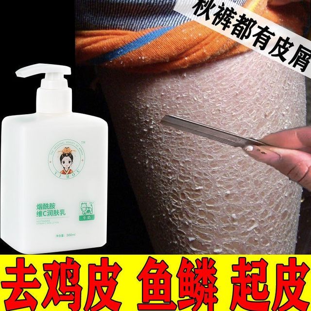 Body lotion, moisturizing and hydrating in winter to remove dry and ...