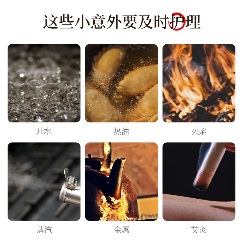 Yongan Tiger Standard Burn Ointment 30g | Genuine Topical Skin Burn ...