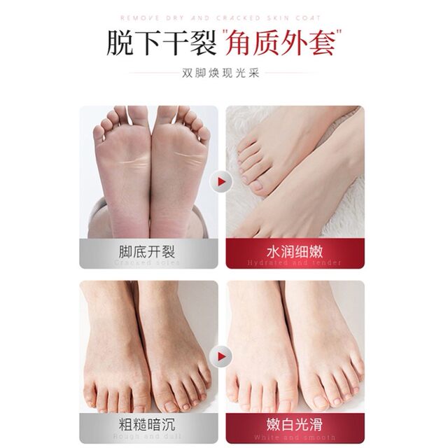 Foot exfoliating spray, dead skin acid essence, heel callus remover ...