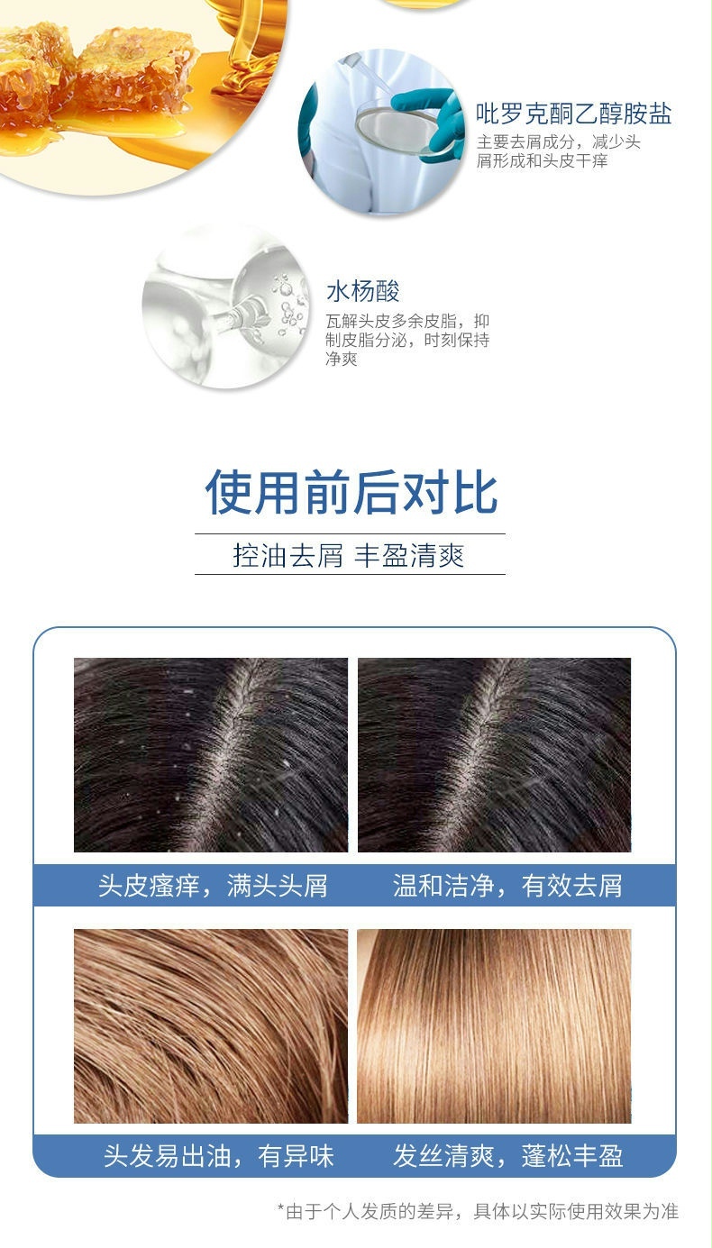 Genuine American Nizoral Renshan Lishu anti-dandruff anti-itch oil control shampoo without ...