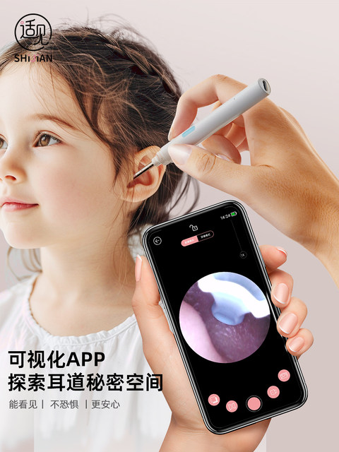 HD Smart Visual Ear Spoon Adult Digging Ear Spoon Children Digging Ear ...