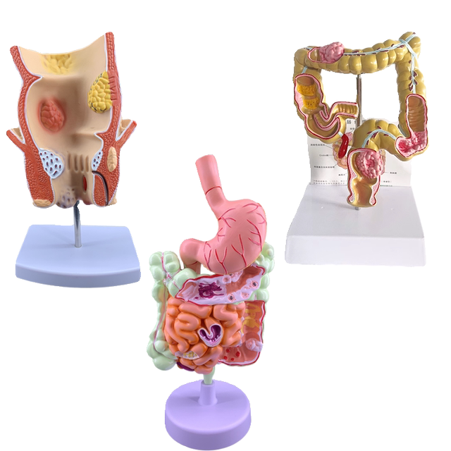 Human intestinal and gastric coronal structure anatomical model ...