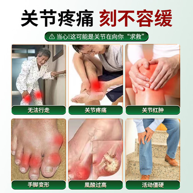 Sanjing Qingfeng Casein Capsule gout dissolved stone crystallization ...