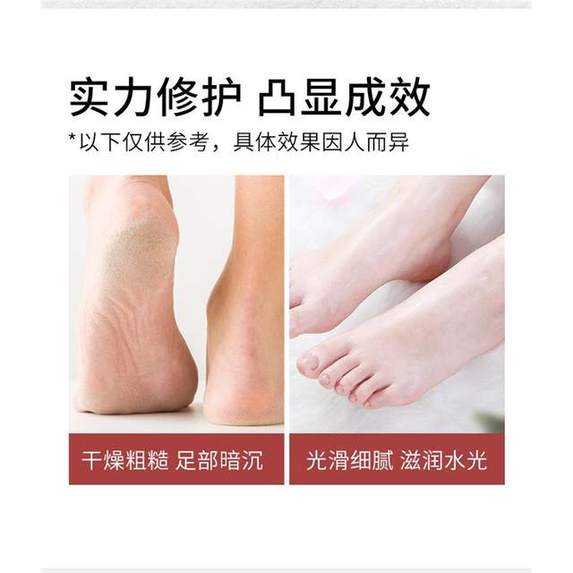 Foot exfoliation, callus removal, dead skin cream, moisturizing ...