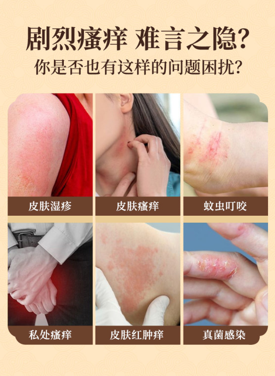 Itching King Hong Kong Pharmacy Flagship Store Itching Cream Skin ...