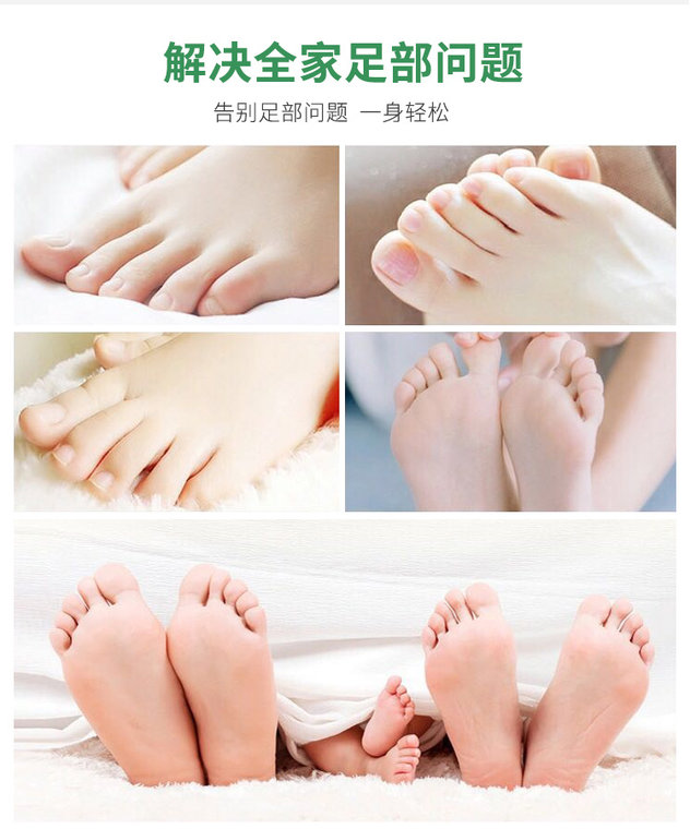 Rotten feet, peeling feet, itchy feet, smelly feet, cracks, new Sanhu ...