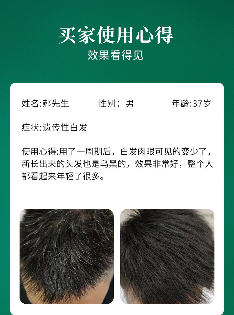 Herbal black mulberry and ginseng hair root shampoo shampoo lotion ...