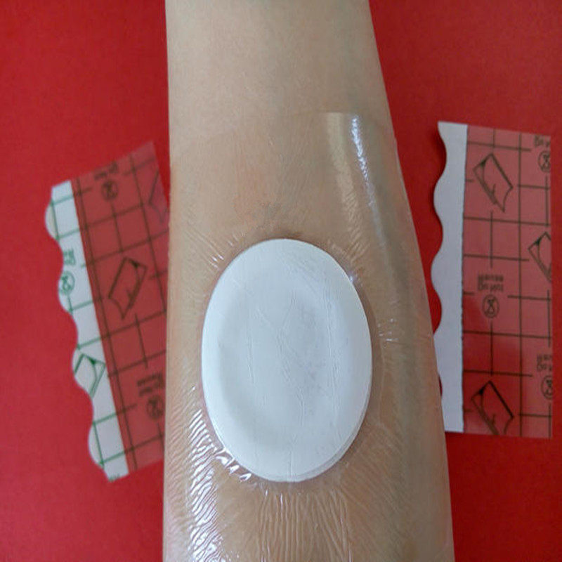 Transdermal patch - adhesive plaster | Sanrui