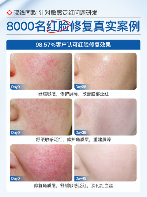 Ceramide original solution removes redness, repairs thin and thickened ...