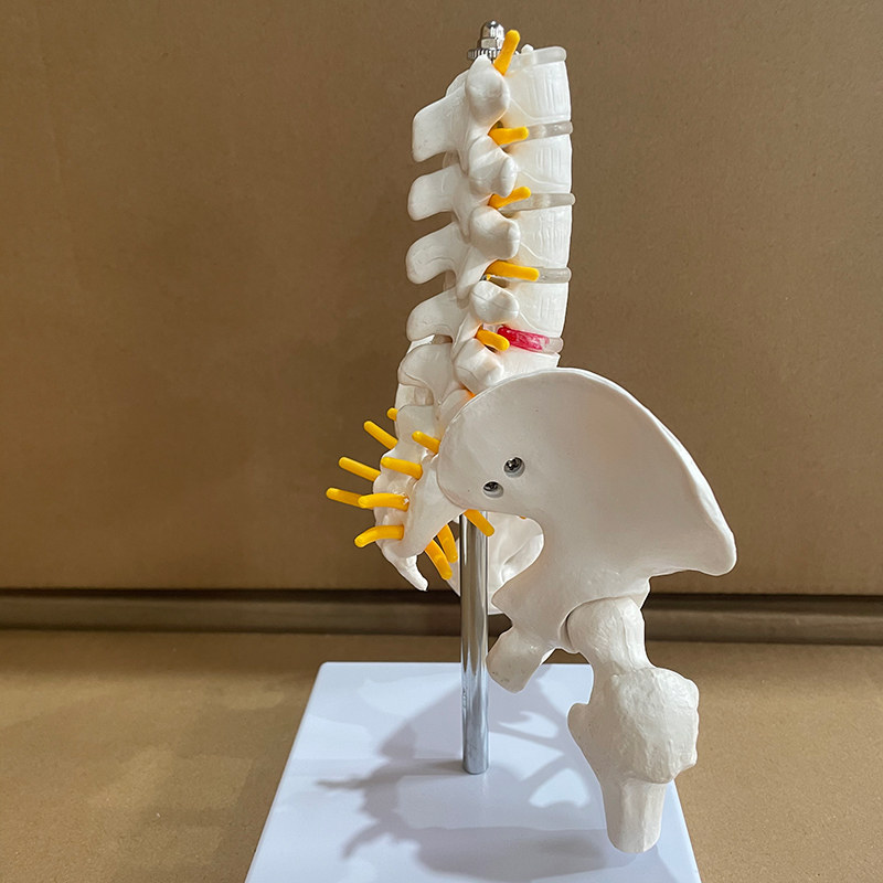 Human Female Movable Pelvis Model - Lumbar Spine Postpartum Repair ...