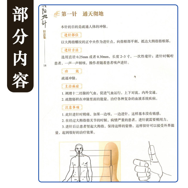 Genuine Yinyang Nine Needle Acupuncture Editor -in -chief Yu Hao ...