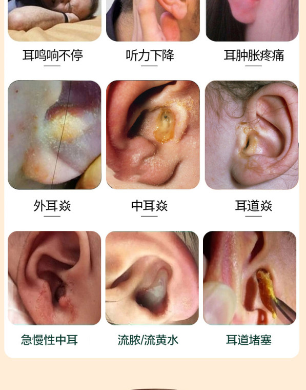 Ear drops for people with itchy ears, antibacterial and antipruritic ...