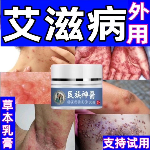 Treatment of HIV/AIDS, viral infection, herpes, papules, itching, acute ...