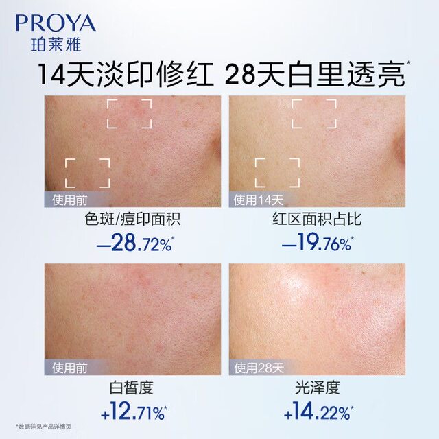 Proya water emulsion set whitening light spots moisturizing skin care ...
