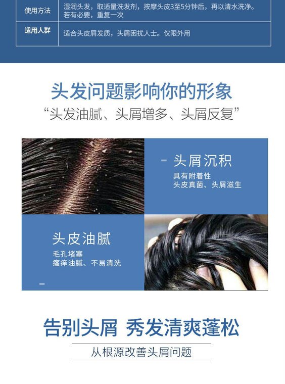 Genuine American Nizoral Renshan Lishu anti-dandruff anti-itch oil control shampoo without ...