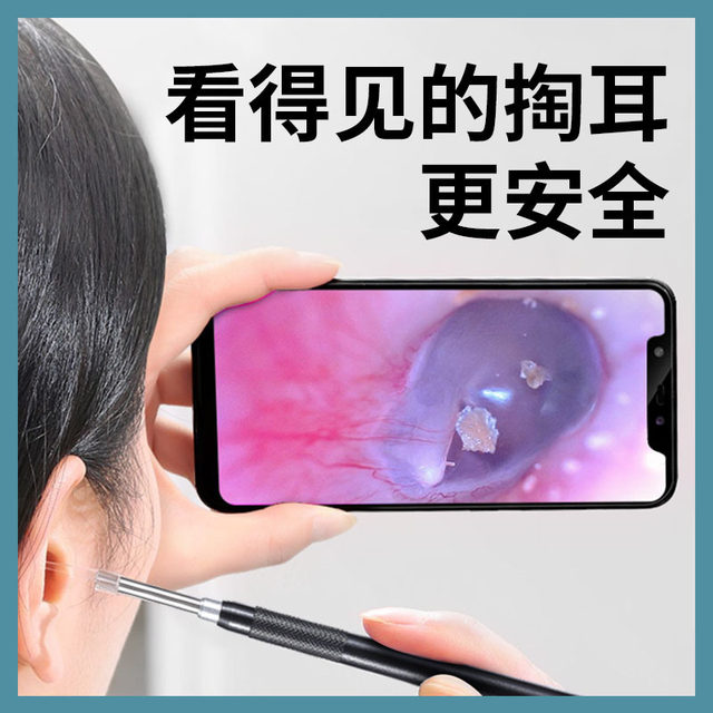 Camera ear pick, visible high-definition ear pick, ear pick artifact ...