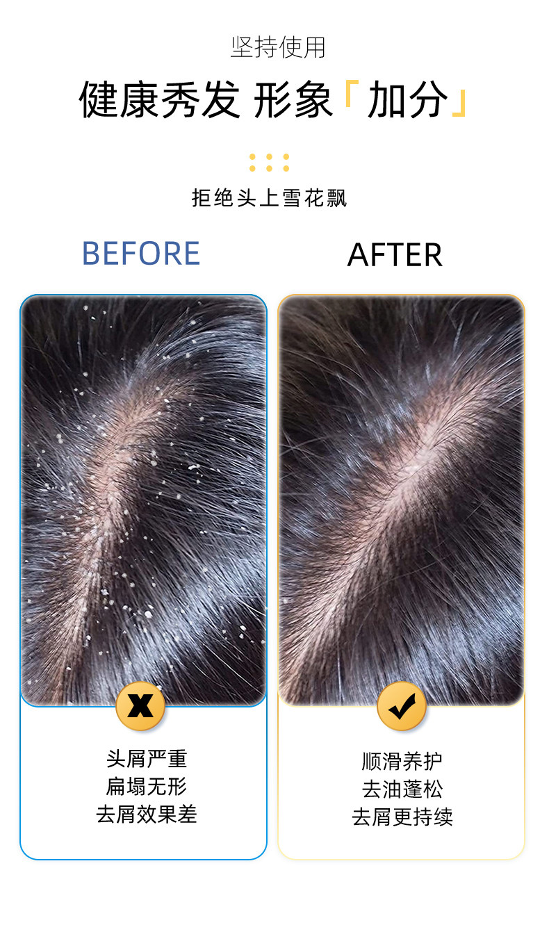 Caile Anti-Dandruff Shampoo | Hair Anti-Itch Degreasing Refreshing Shampoo