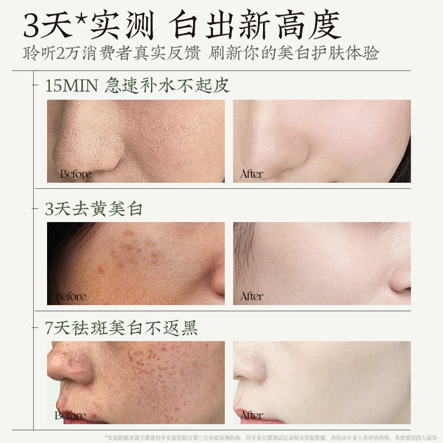 377 whitening mask for sleeping, removing sallowness, brightening ...