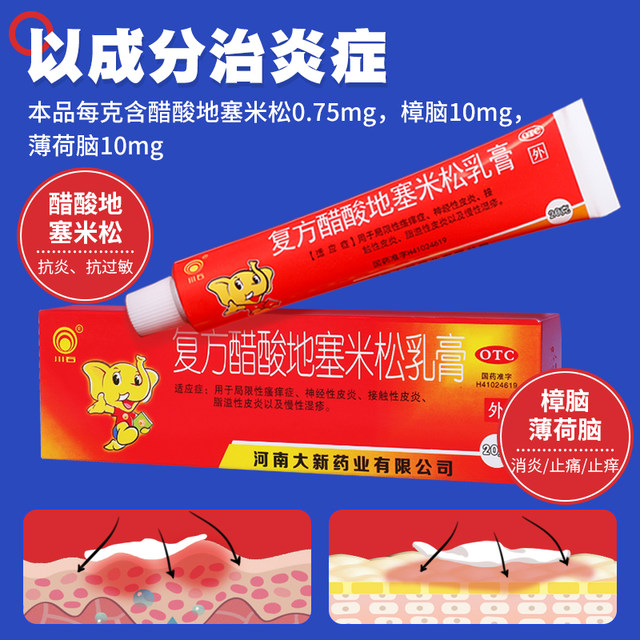 Compound dexamethasone acetate cream to remove skin eczema and relieve ...