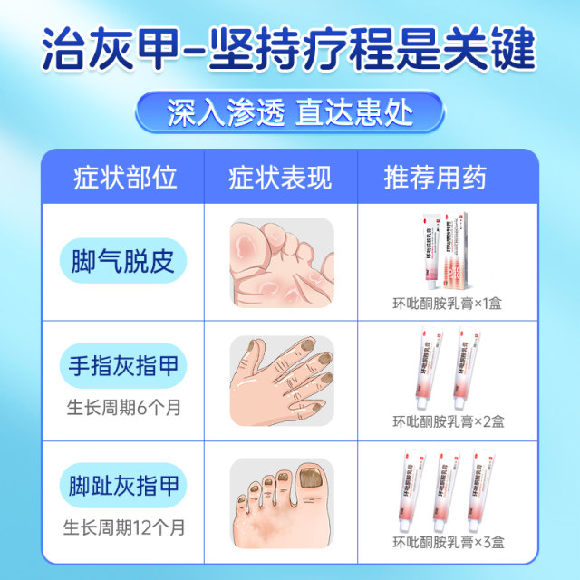 Ciclopirox amine cream, special medicine for onychomycosis, genuine ...