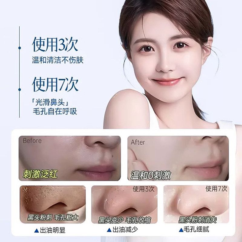 Blackhead Removal Nose Patch Powder Strawberry Nose White Nose Patch ...