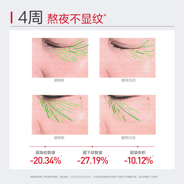 Marumi Little Red Pen Eye Cream Massage Head Fades Dark Circles Eye ...