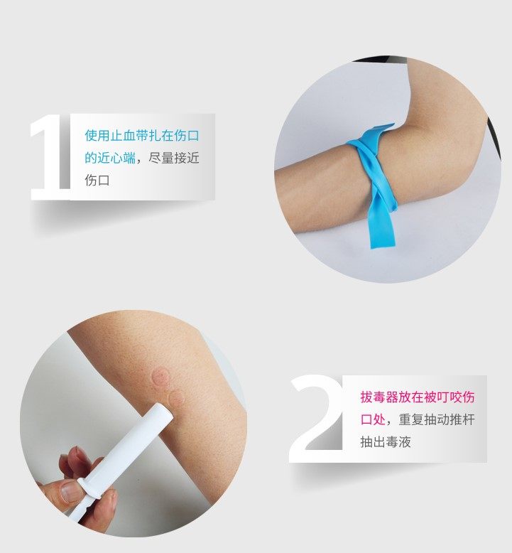 Venom Vacuum Extractor, Outdoor First Aid Supplies, Inhaler, Field ...